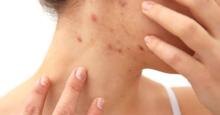 ทำไมถึงเป็นสืวที่คอ | Dek-D.com