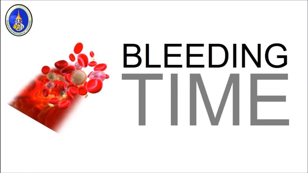 แบบทดสอบความรู้วิธีปฏิบัติการทดสอบ Bleeding Time (Ivy method) โดย ...